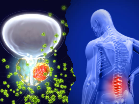 Pain in the lower part of the body is a symptom of prostate cancer.